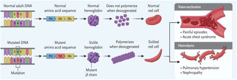 首个基因编辑疗法获批，定价超千万，我们离基因治疗时代还有多远？ 知识分子的财新博客 财新网