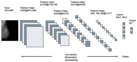 Bi Rads Based Classification Of Mammographic Soft Tissue Opacities