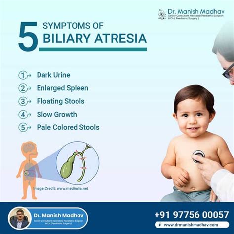 5 Symptoms Of Biliary Atresia Pdf