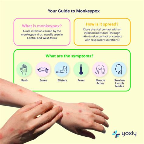 Monkeypox And Sexual Health Whats The Link Yoxly Store