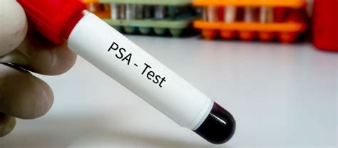 Prostate Specific Antigen Psa Explained Prostate For Dummies