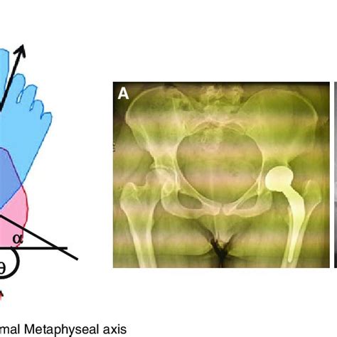 Definition Of Vertex Height Download Scientific Diagram