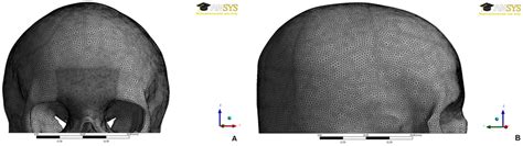 The Finite Element Skull Model A Fe Model Meshed With Small Download Scientific Diagram