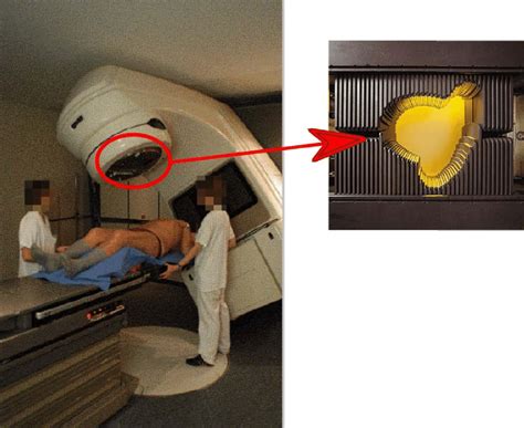 2 Linear Accelerator Left And Multileaf Collimator Right