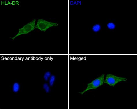 Hla Dr Recombinant Rabbit Monoclonal Antibody Sc06 78 Et1610 66