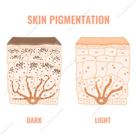 Skin Pigmentation Illustration Stock Image F0365674 Science