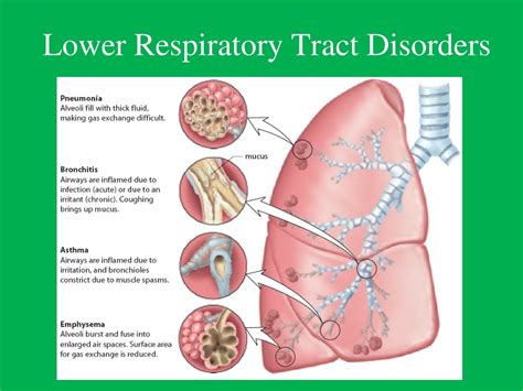Ppt The Respiratory System Powerpoint Presentation Free Download