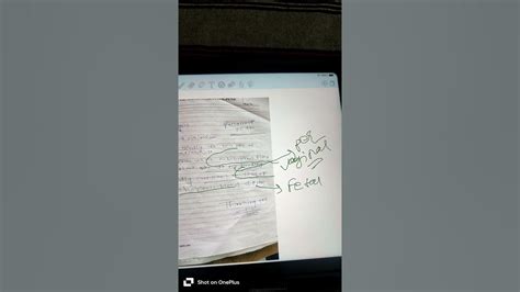 Subchorionic Bleed Learning From Cases Youtube