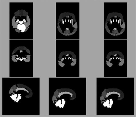 Three 2d Cross Sections Are Made Through The Center Of Three 3d Volumes Download Scientific