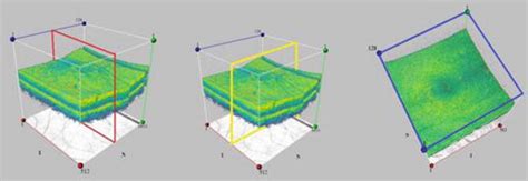 Three Dimensional Spectral Domain Optical Coherence Tomography Ento Key