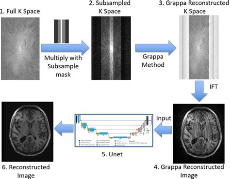 Figure From Deep Learning Based Acceleration Of MRI For Radiotherapy Planning Of Pediatric