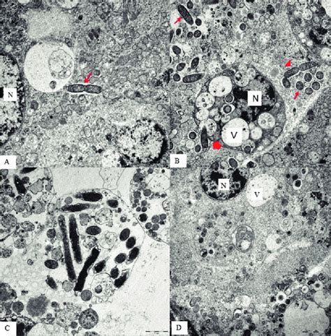 Microscopio Rickettsia Rickettsii