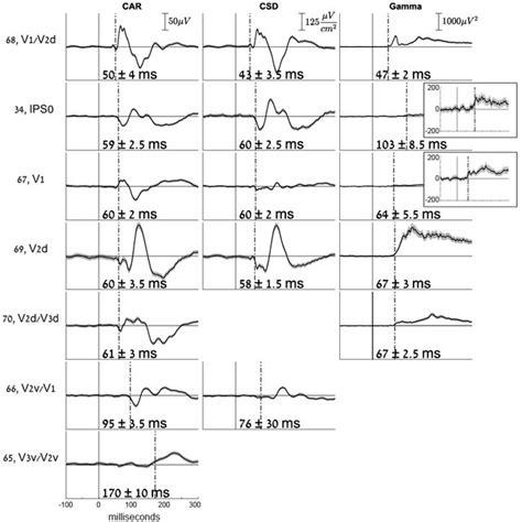 Figures Figure 1 Illustration Of The Onset Latency Estimation Method Download Scientific Diagram