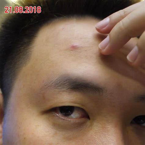 อัพเดทผิวกันแบบ Hd Cc Siera เพื่อผิวแพ้ง่ายโดยเฉพาะ Facebook