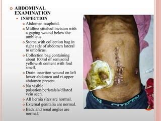Loop Ileostomy PPTX