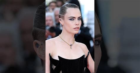 Cara Delevingnes Bruised Legs And Excessive Hand Rubbing Sparks Concern