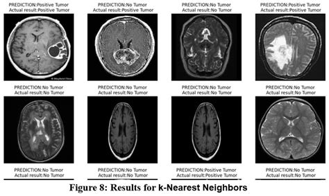Automated Brain Tumor Detection With Advanced Machine Learning Techniques Biomedical And