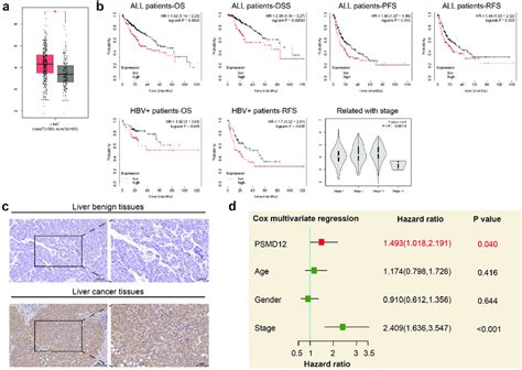 Psmd12 Was Highly Expressed In Liver Cancer Tissues And Indicated A