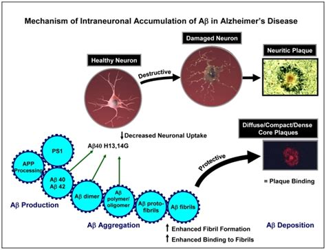 Two Pathways For The Production Of Amyloid Plaques Are Displayed One