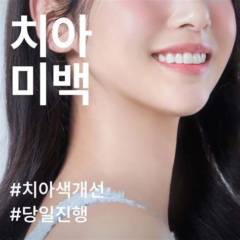 미소 밝은 오늘 치아미백 할인 가격 후기 전후 효과 정보 By 서울오늘치과의원 여신티켓 국내 1등 피부과 성형외과 플랫폼