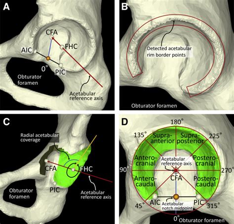 Computed Tomographybased Three Dimensional Analyses Show Similarities In Anterosuperior