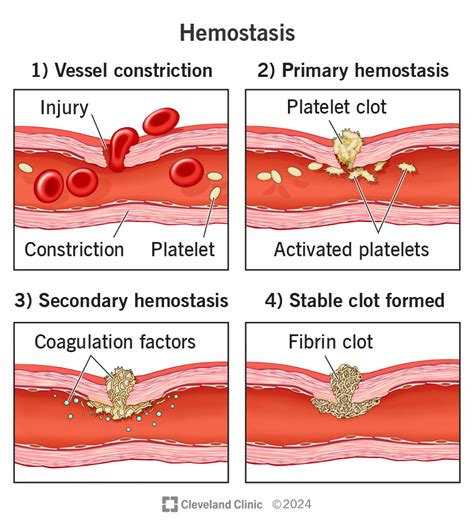 Types Of Clotting Disorders