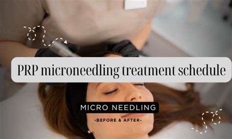 How To Microneedle Scalp