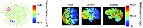 Electrode Montage And Underlying Left Hemisphere Cortical Regions To
