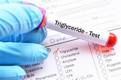 Was Ist Ein Triglyceridtest Triglyceride Definition Und Bedeutung