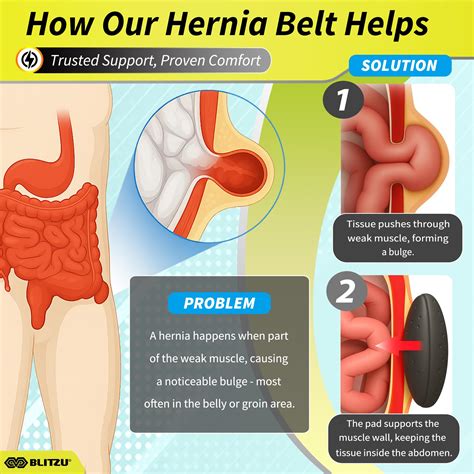 Hernia Belt For Bilateral Double Or Single Inguinal