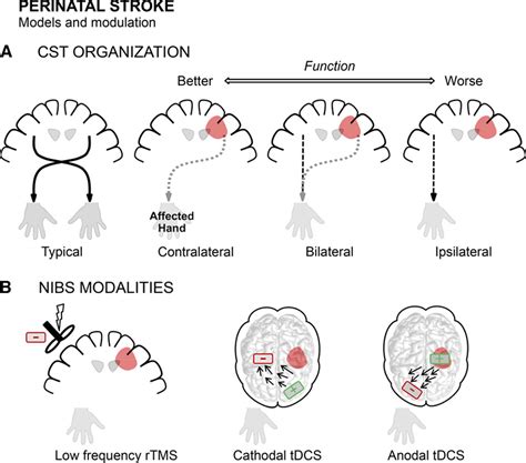 Noninvasive Neuromodulation To Promote Motor Skill Gains After