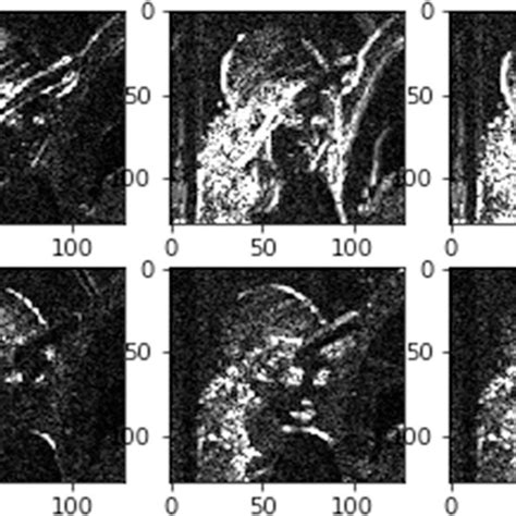 Sub‐band Of Image After Taking Dtcwt Download Scientific Diagram