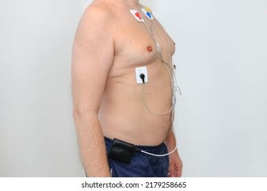 Interpretation Ecg Images Stock Photos Vectors Shutterstock