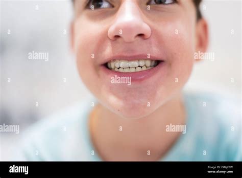 Teenager Boy Wear Simulator Orthodontic Silicone Invisible Leveling