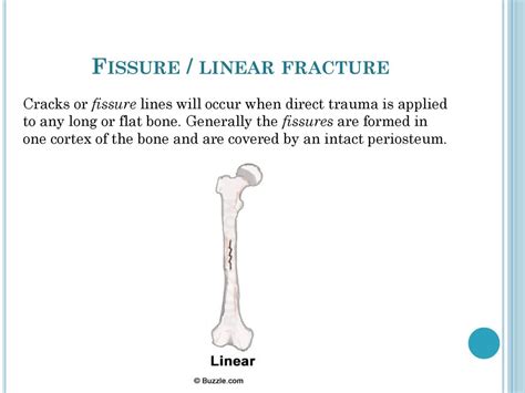 Linear Fracture