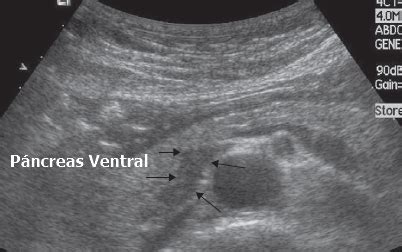 Ultrasonido Del Pancreas Gastro Mérida