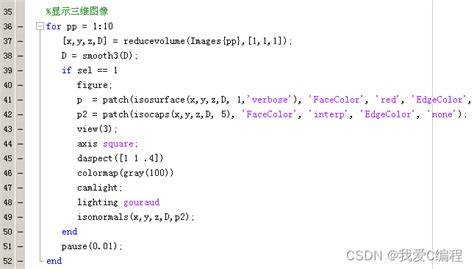 M基于lk光流提取算法的三维医学图像运动估计matlab仿真lk光流法 Matlab Csdn博客