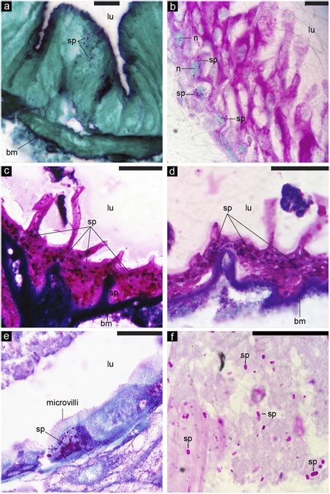 Nosema Spores Developing Intracellularly In The Midgut Cells Of Bees At Download Scientific