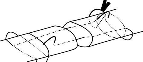 The Modified Side Locking Loop Technique Suggested By The Author The Download Scientific