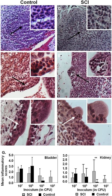 Both Sci And Control Rats Develop Cystitis And Pyelitis During Acute