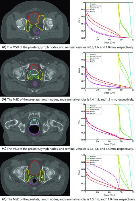 Examples From The Automatic Contours Propagation Of The Hmc Dataset And Download Scientific