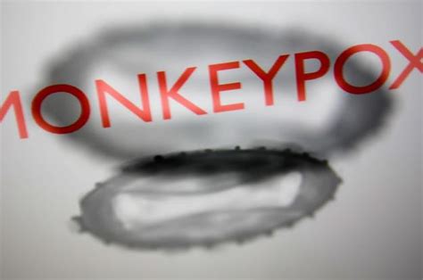 Experts Suggest Monkeypox May Have Been Circulating For Years Complex