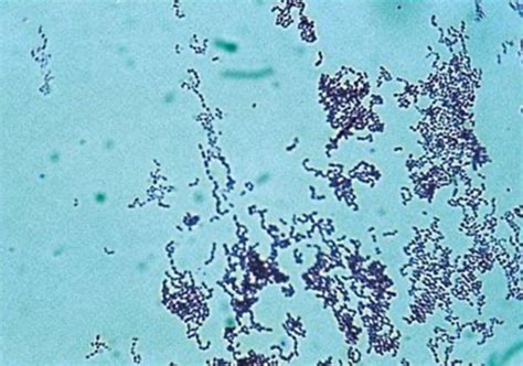 Catalase Gram Cocci Streptococcus Enterococcus And Similar