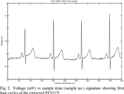 Figure 1 From Noise Reduction Of Electrocardiographic Signals Using Wavelet Transforms