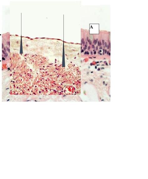 Solved Identify A And The Arrows