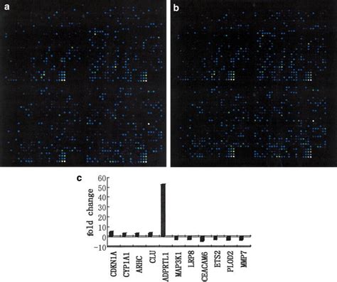 oligonucleotide microarray analysis human breast cancer mcf 7 cells