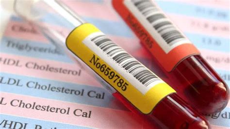 Hyperlipidemia Symptoms Causes Diagnosis And Treatment Page 7 Entirely Health