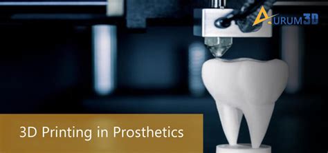 3d Printing In Prosthetics 3d Printing Use Cases 3d Printing