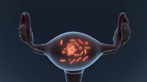 A Rare Sexually Transmitted Disease May Turn Into A Superbug YouTube