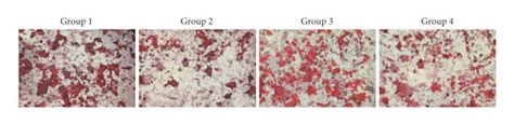 a the extracellular matrix mineralization in adscs od was detected by